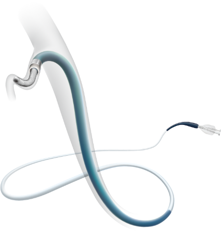 Progreat Lambda™ Micro Catheter System